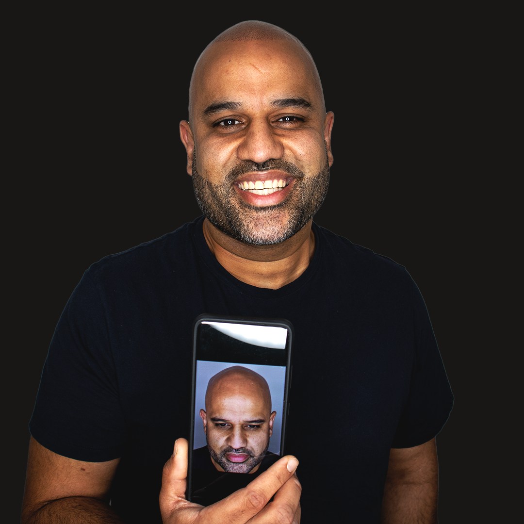 Treatments - SMP Studio